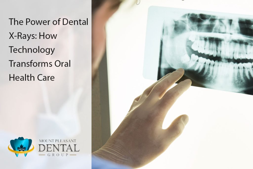 The Power of Dental X-Rays: How Technology Transforms Oral Health Care ... The Power of Dental X-Rays: How Technology Transforms Oral Health Care ...