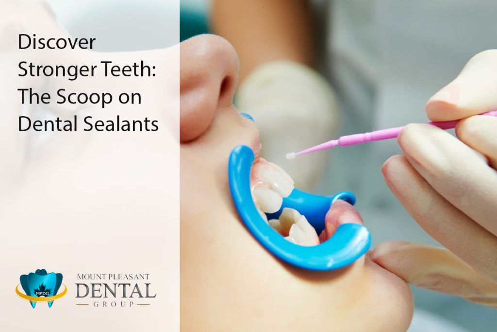 Discover Stronger Teeth: The Scoop on Dental Sealants - Mount Pleasant ...